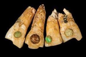 Gem-Studded Teeth Reveal Remarkable Skills Of Ancient Mayan Dentists ...