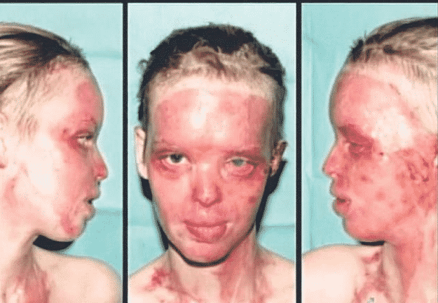 aspiring model face destroyed 9 | Elite Readers