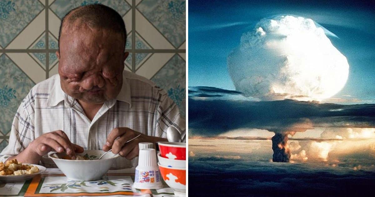 23 Images That Show The Harrowing Effects of Nuclear Weapons – Elite ...