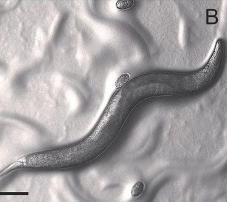10 Disturbing Parasites That Perfectly Showcase The Weird Side Of ...