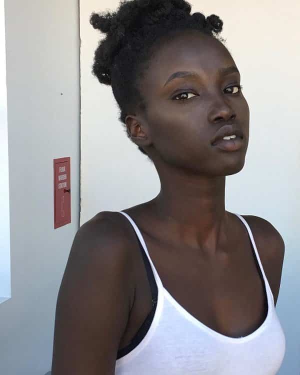 Student With Unique Skin Color Lands Modeling Contract After Her Photos ...