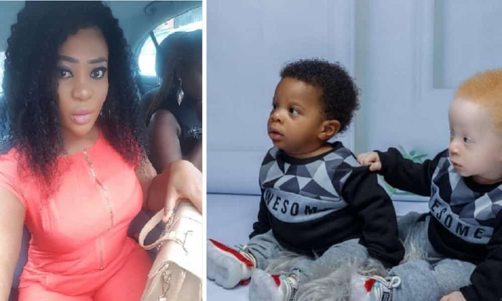 Meet the World's Oldest Living Conjoined Twins. These Record Holders ...